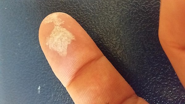 Peróxido de hidrógeno: qué es, estructura, propiedades, usos y riesgos