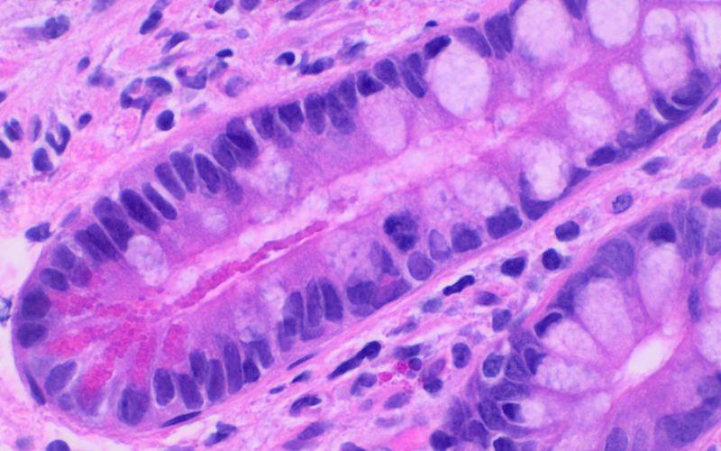Células de Paneth: qué son, características, funciones e histología