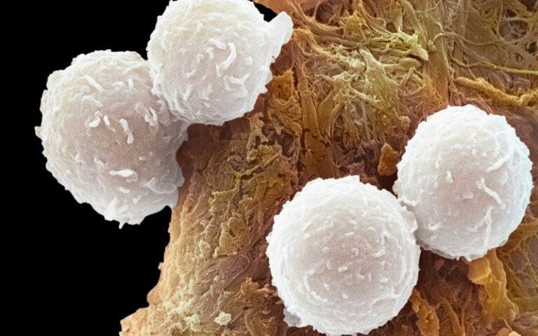 Linfocitos B: qué son, características, estructura, funciones, tipos