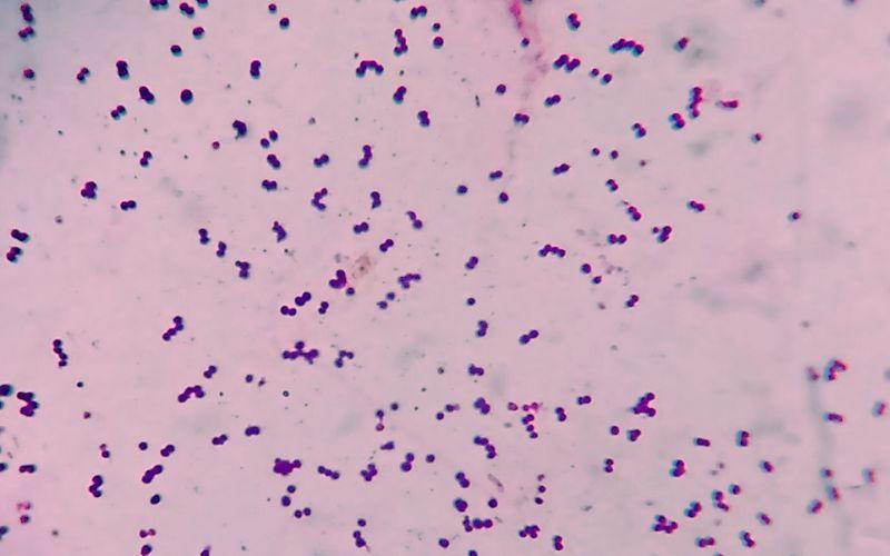 Bacterias grampositivas: qué son, características, estructura, ejemplos