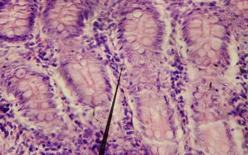 Criptas de Lieberkühn: qué son, histología, funciones