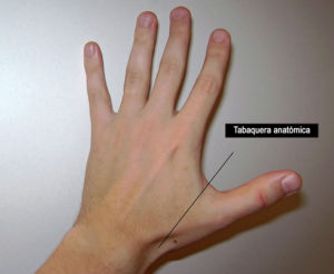 Tabaquera anatómica: límites, contenido, funciones, lesiones