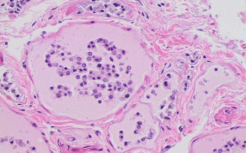 Autólisis: qué es, causas, fases y consecuencias