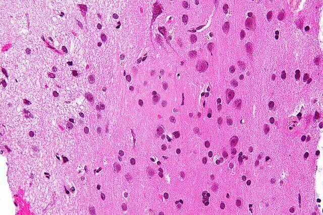 Sustancia gris: función, histología, localización