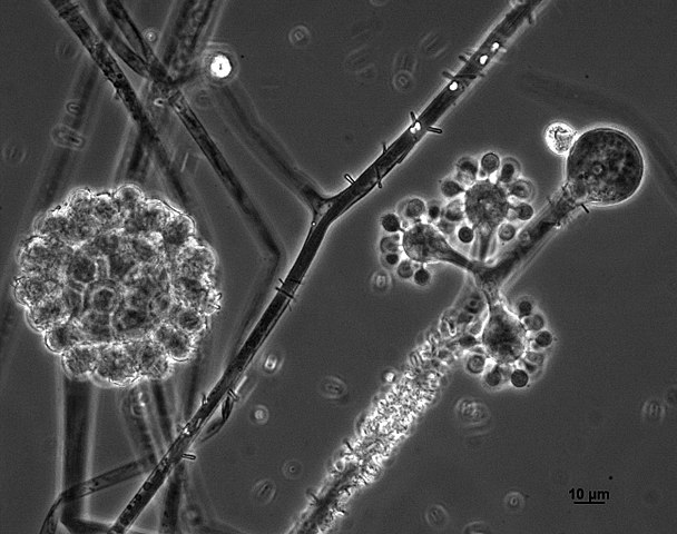 Morfología de los hongos