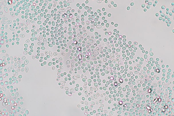 Morfología de los hongos