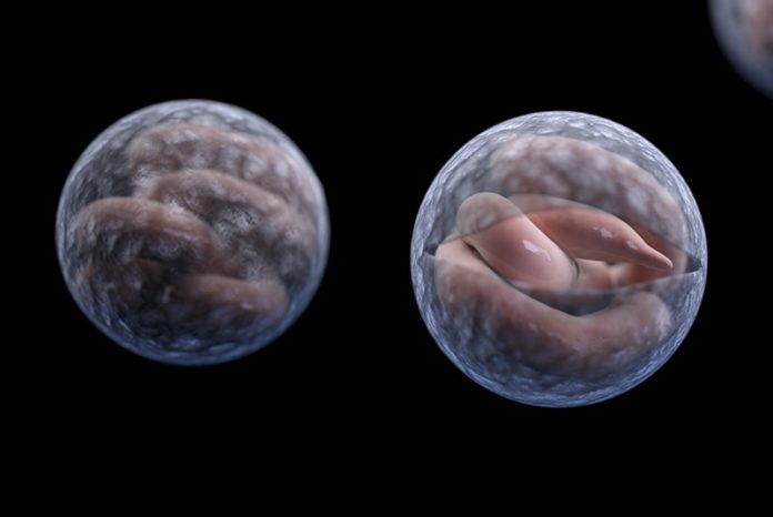 Cryptosporidium: características, especies, contagio, síntomas