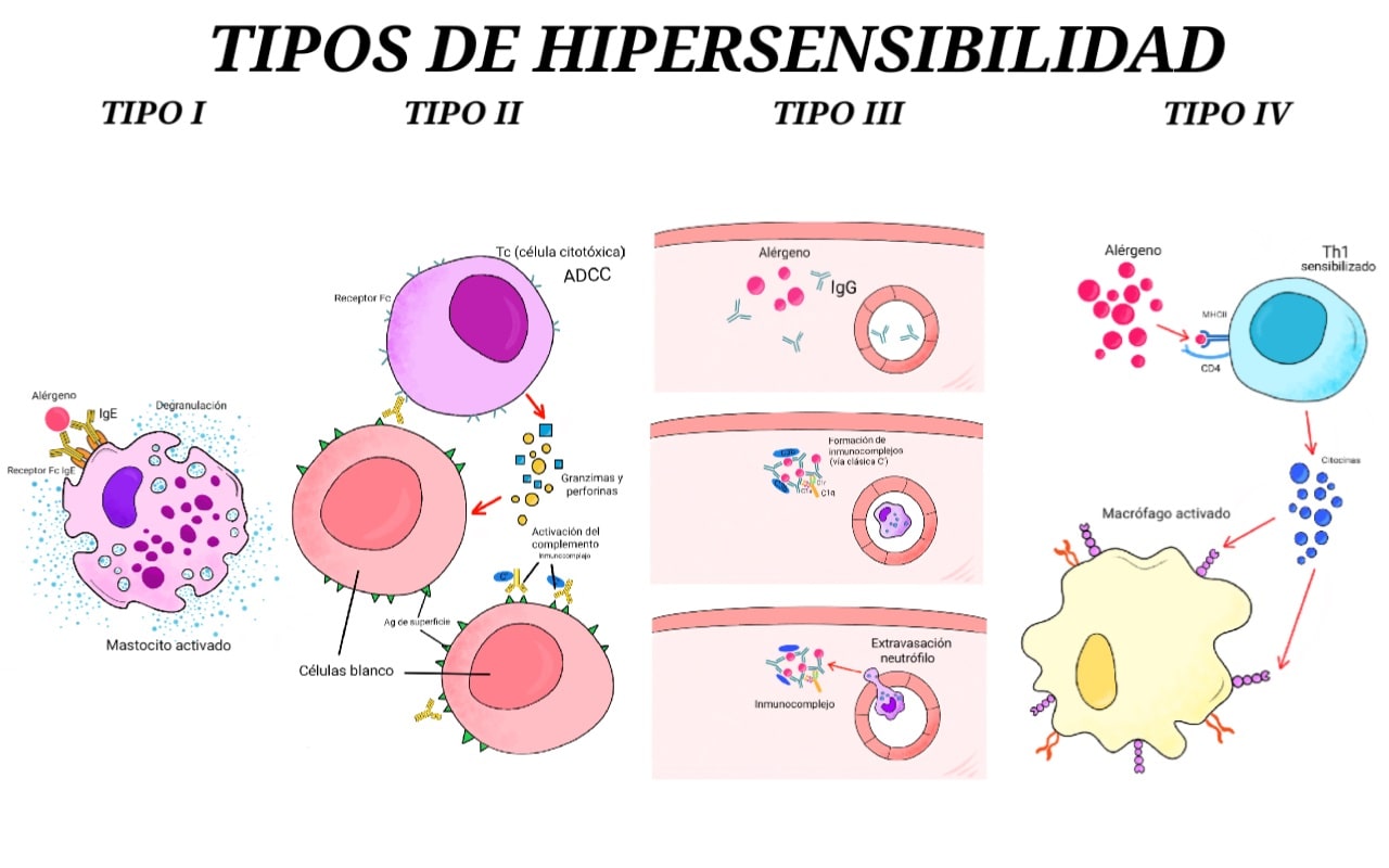 Hipersensibilidad tipo IV: en qué consiste y ejemplos Hipersensibilidad tipo IV: en qué consiste y ejemplos