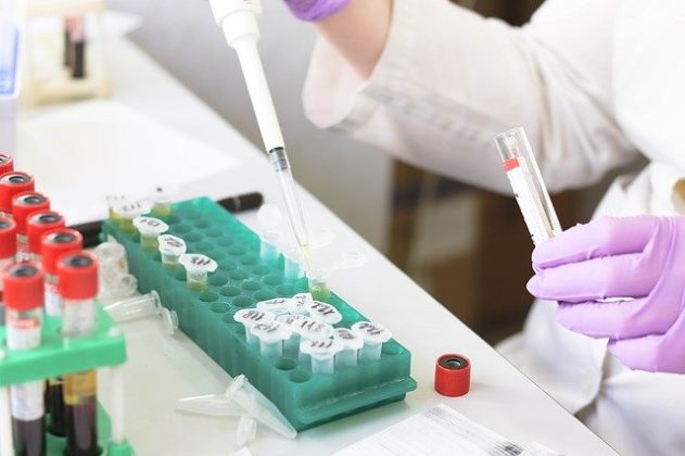Pruebas bioquímicas: fundamento, tipos, ejemplos