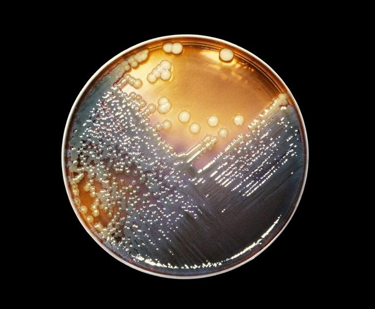 Morfologia De Enterobacter Aerogenes