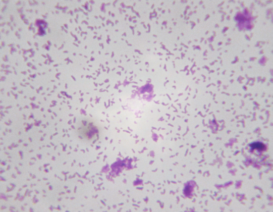 Corynebacterium: qué es, características, taxonomía, morfología, cultivo